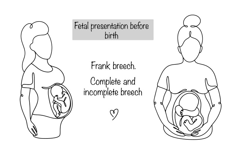 Forceps Drawing Sketch Vector Images (52)