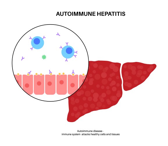 Hepatitis C Vector Images within Science (over 110)