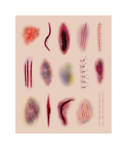Surgery Medical Stitches Vector Images (over 430)