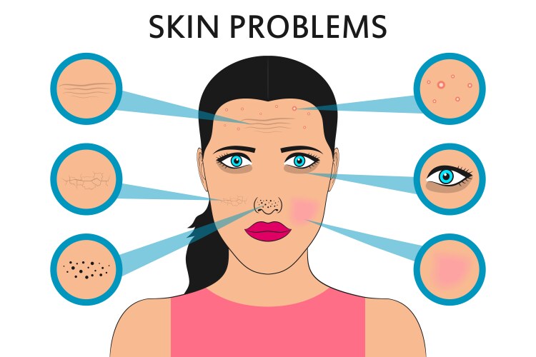 Female face with skin problems Royalty Free Vector Image