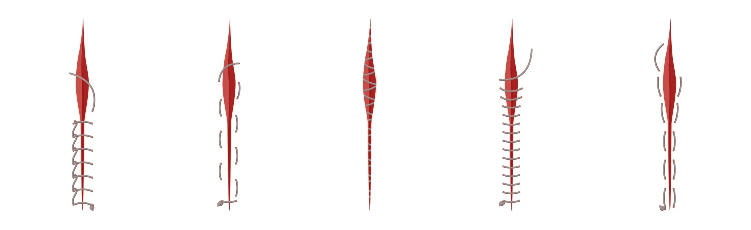 Series of different medical stitches isolated Vector Image