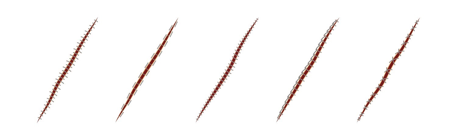 Series of different medical stitches isolated Vector Image