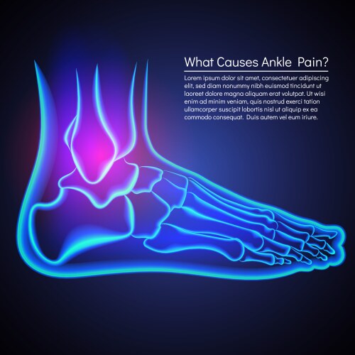 Ankle Vector Images (over 11,000)