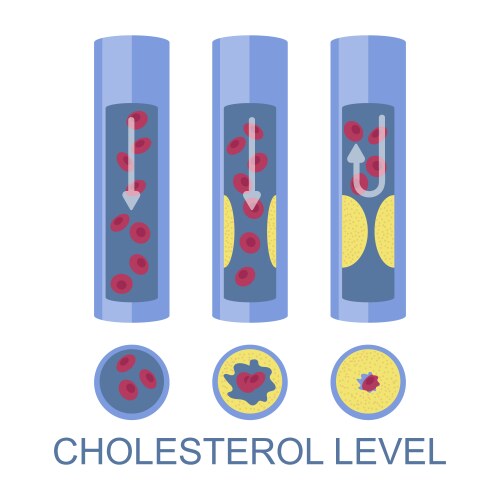 Cholesterol Vector Images (over 16,000)