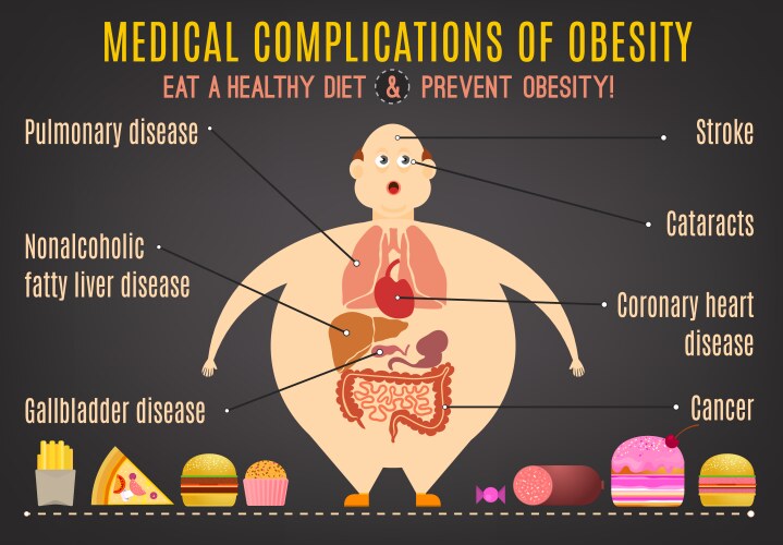 Obesity Infographics Vector Images (over 1,500)