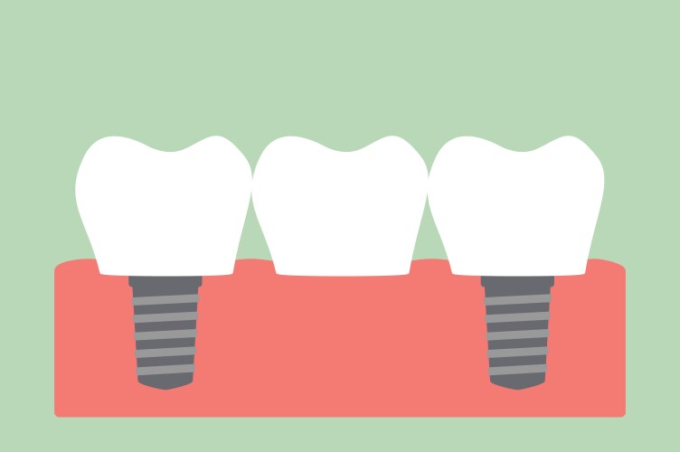 Bridge cartoon Vector Images & Graphics for Commercial Use | VectorStock