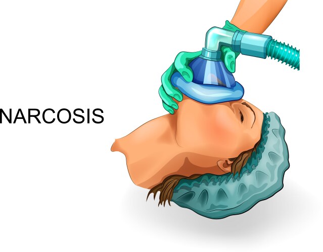 General Anesthesia Vector Images (over 310)