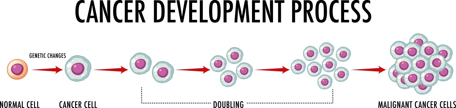 Process of cancer development infographic Vector Image
