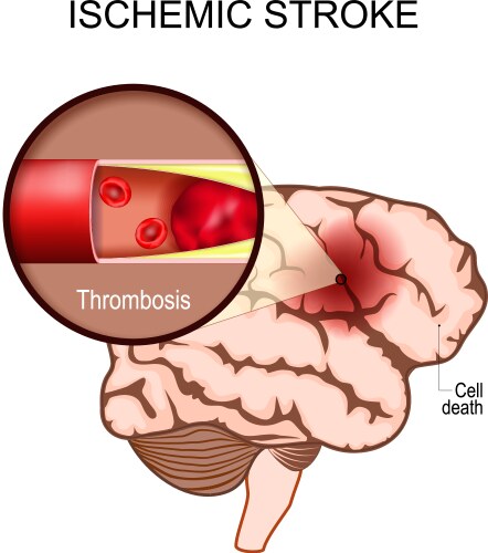 Stroke logo icon design medical Royalty Free Vector Image