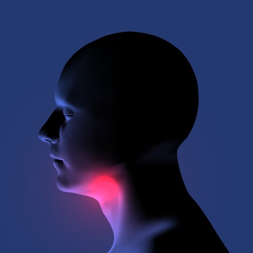 Laryngitis human throat Royalty Free Vector Image