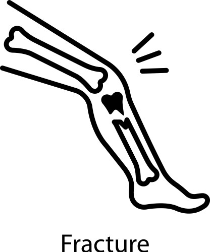 Fracture Vector Images (over 56,000)