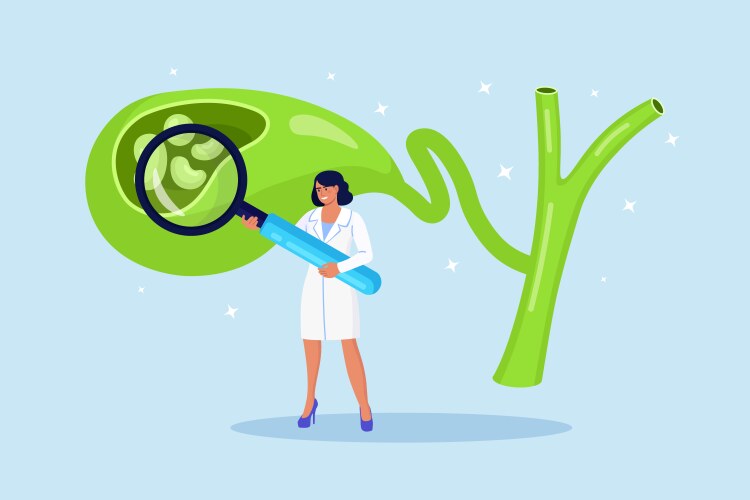 Gall Bladder Stone Vector Images (over 140)