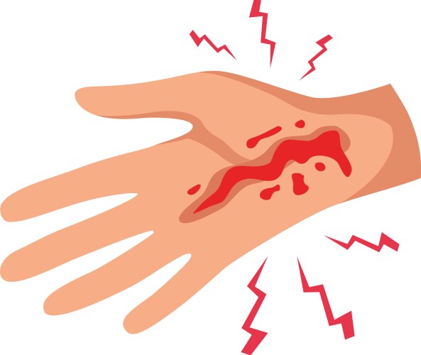 Hand Injury Vector Images (over 17,000)