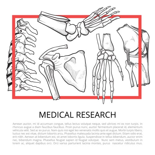 Bone and skeletal diseases set with medical names Vector Image