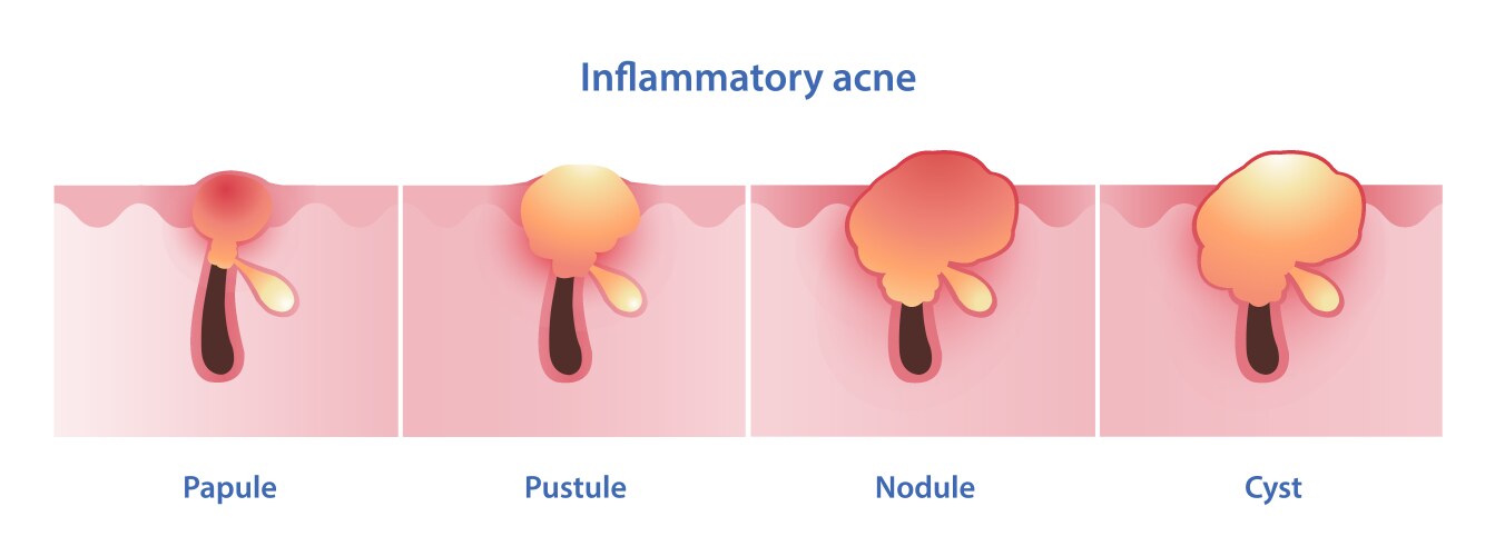 Inflammatory Vector Images (over 2,800)