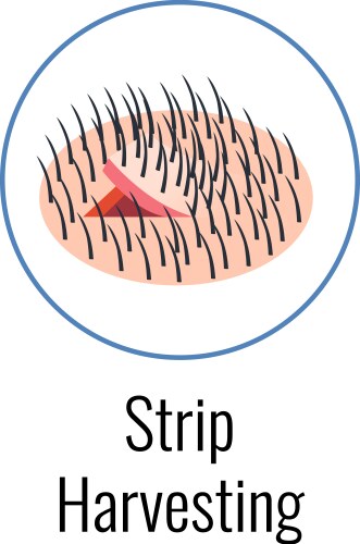 Alopecia grafts implantation composition Vector Image