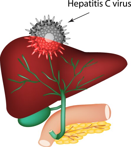 Hepatitis C Vector Images within Science (over 110)