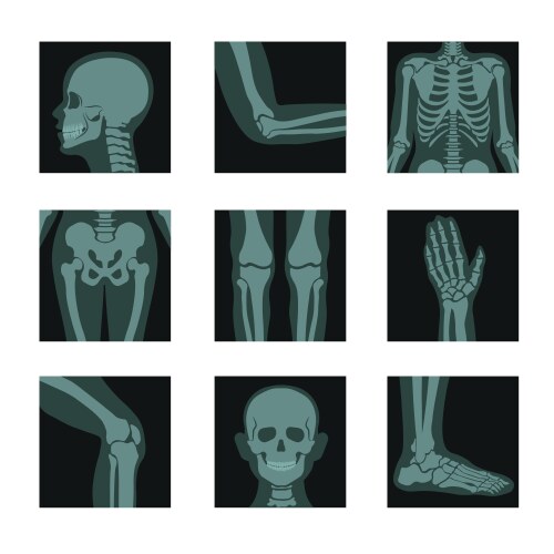 Radiography Vector Images (over 2,300)