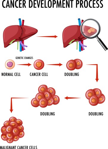 Cancer development process infographic Royalty Free Vector