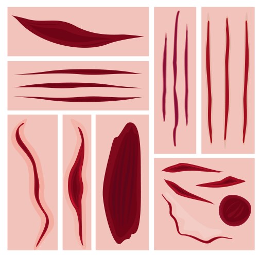 Realistic surgical stitches scars bruise Vector Image