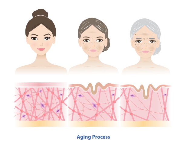 Cross section of aging process skin comparison Vector Image