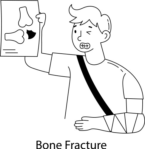Bone fracture Royalty Free Vector Image - VectorStock