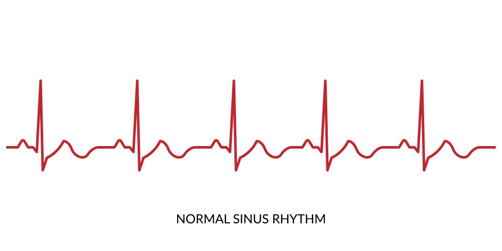 Normal electrocardiogram ecg eps 8 Royalty Free Vector Image