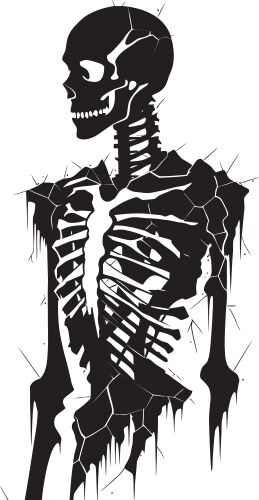 Split spine skeleton symbol fragmented fusion Vector Image
