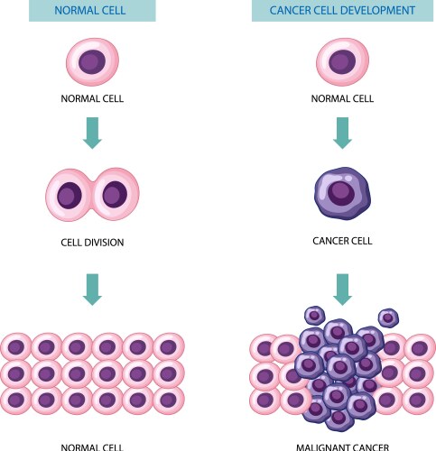 Process of cancer cell development Royalty Free Vector Image