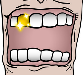 Gold Tooth Vector Images (over 1,800)