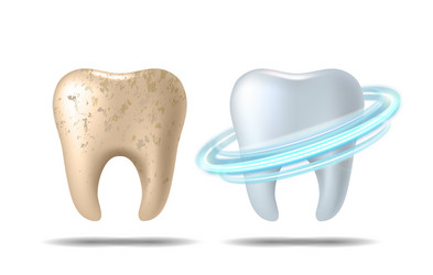 Clean and dirty tooth before and after whitening Vector Image