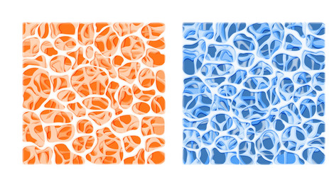 Bone Density Vector Images (over 240)