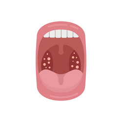 Tongue tonsillitis icon flat mouth tonsil Vector Image