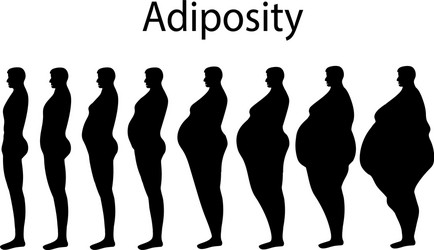 Obesity Royalty Free Vector Image - VectorStock