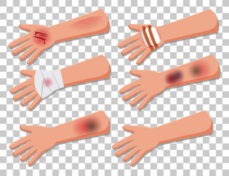 Finger Injured Cartoon Vector Images (over 130)