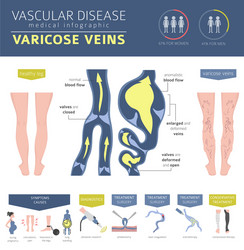 Varicose veins symptoms and preventions poster Vector Image