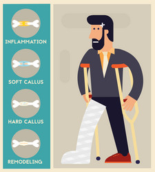 Bone fracture character cartoon Royalty Free Vector Image