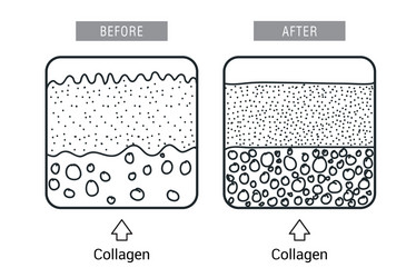 Collagen Skin Diagram Vector Images (over 260)