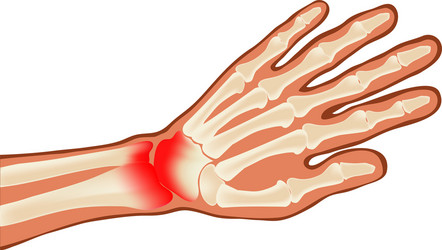 Hand Pain Vector Images (over 19,000)