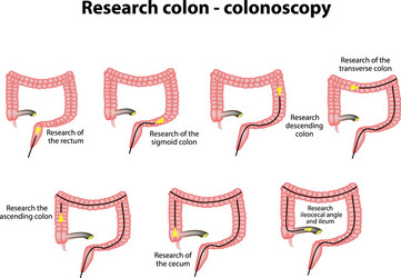 Colonoscope Vector Images (61)