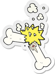 Broken Bone Cartoon Vector Images (over 1,600)