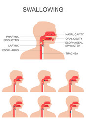 Dysphagia Vector Images (over 220)