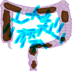 Treatment constipation infographics Royalty Free Vector