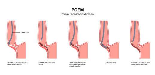 Poem medical poster Royalty Free Vector Image - VectorStock