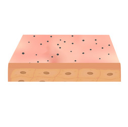 Open comedones acne on skin dermatological Vector Image