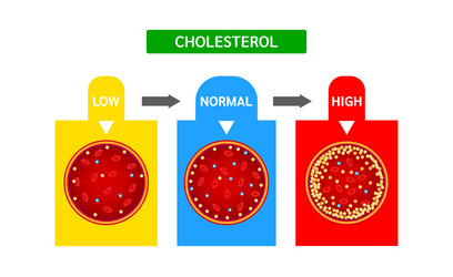 Types of cholesterol Royalty Free Vector Image