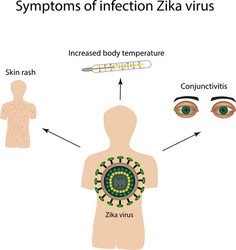 Zika virus transmission cycle infographics Vector Image