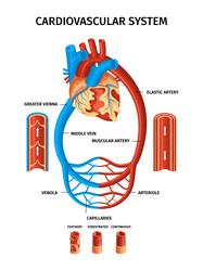 Stent Vector Images (over 130)