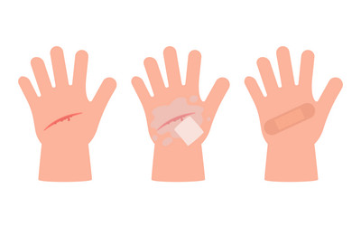 Wound of hand human skin scratch cut injury Vector Image
