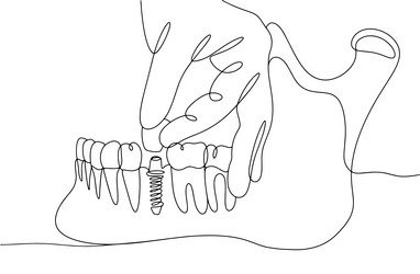 Dental technician insert jaw one line Royalty Free Vector